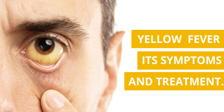 Yellow fever Symptoms And Causes - Health GadgetsNG