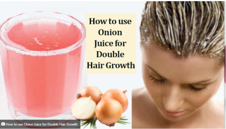 HOW TO USE ONION JUICE FOR DOUBLE HAIR GROWTH - Health GadgetsNG